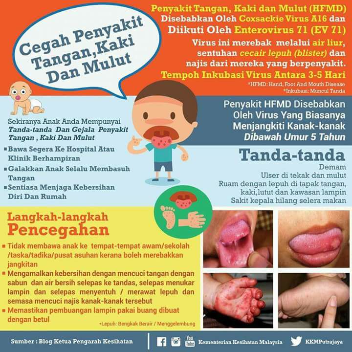Hand, Foot and Mouth Disease: Its Symptoms and Severity That You Should ...